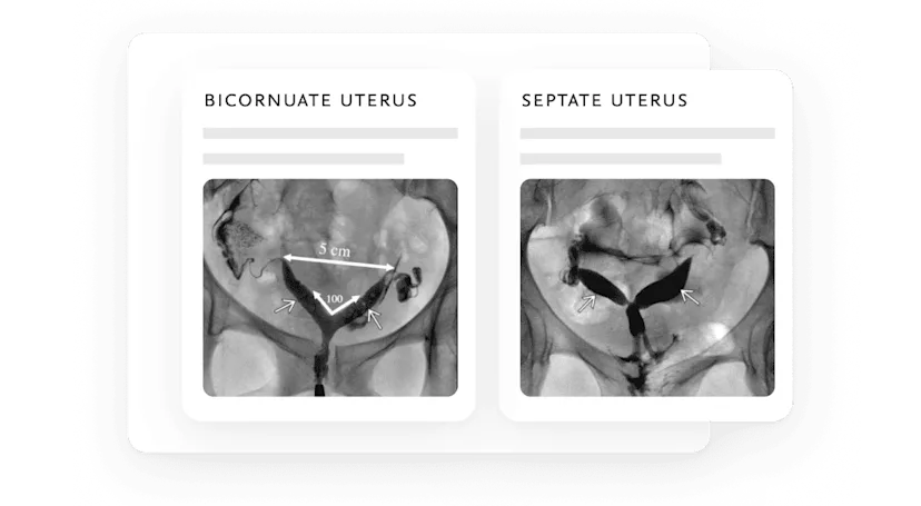 Clinical Decision Support for Radiology | STATdx | Elsevier