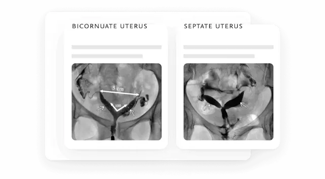 종합적인 영상의학 교육과정 | RADPrimer | 엘스비어