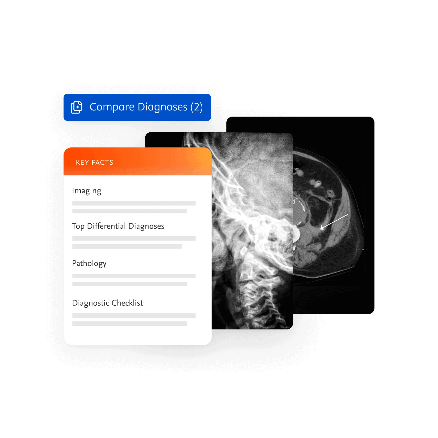 Clinical Decision Support for Radiology | STATdx | Elsevier