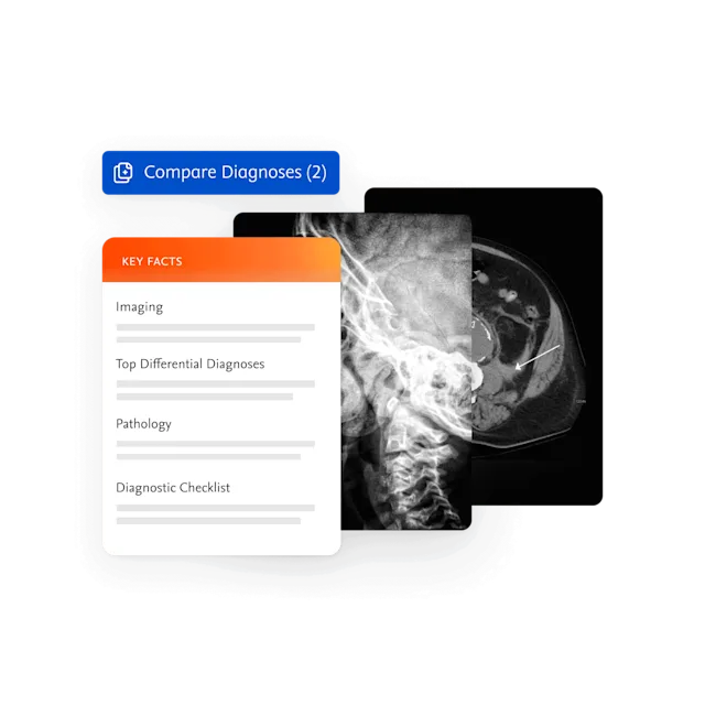 Clinical Decision Support for Radiology | STATdx | Elsevier