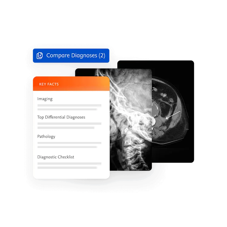 Clinical Decision Support for Radiology | STATdx | Elsevier