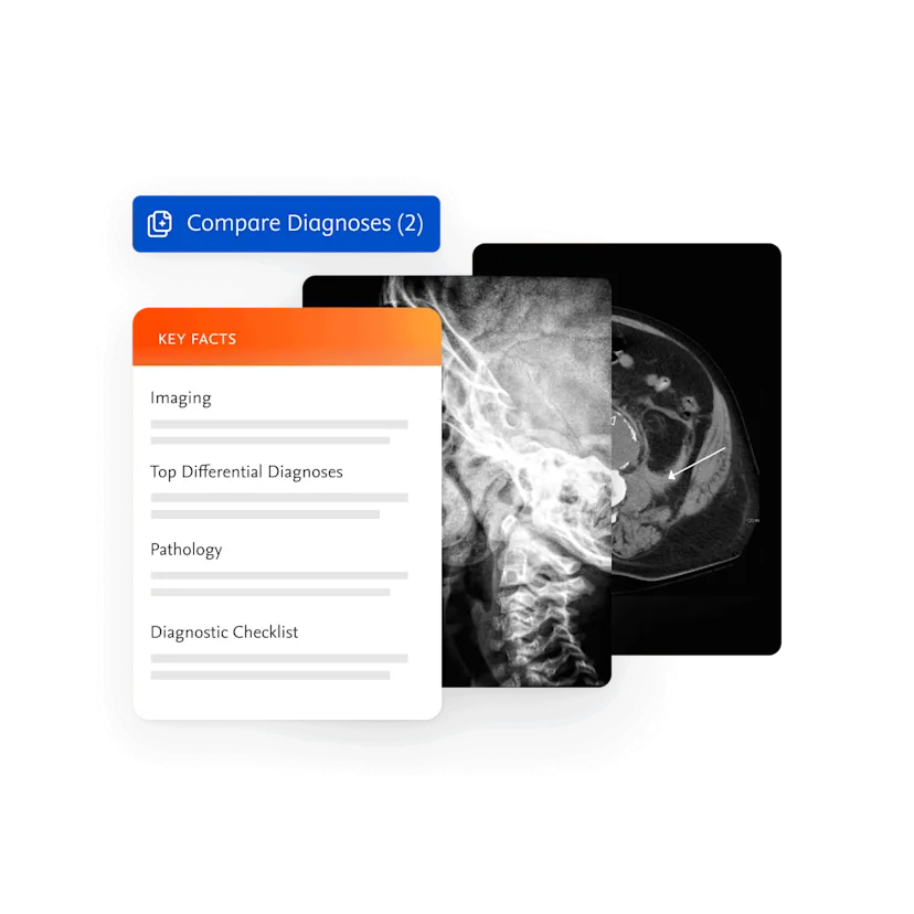 Clinical Decision Support for Radiology | STATdx | Elsevier