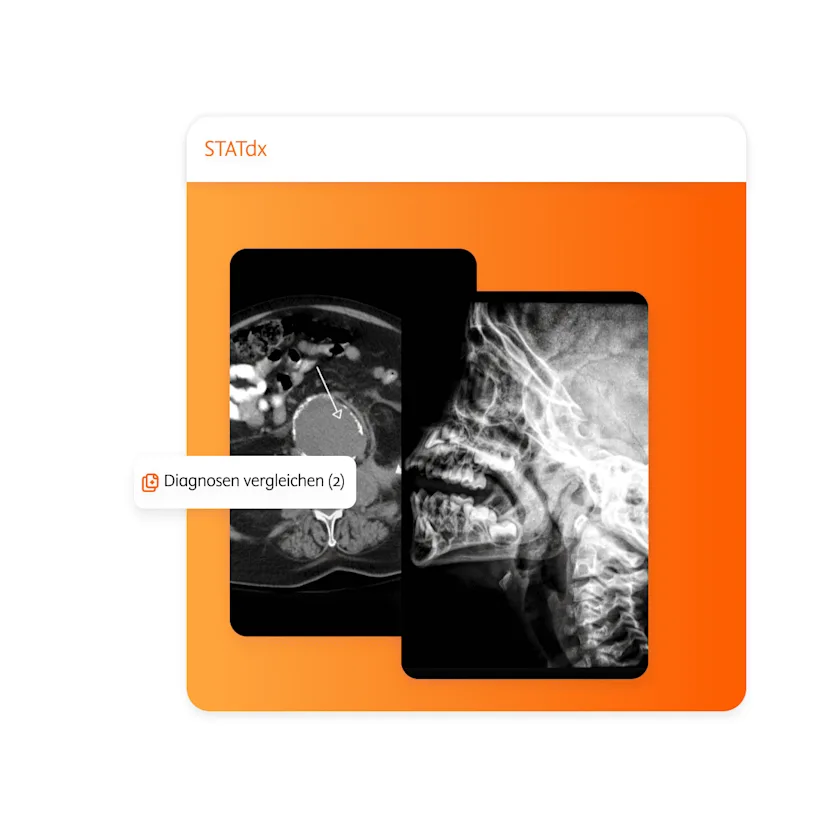 Clinical Decision Support für die Radiologie | STATdx | Elsevier