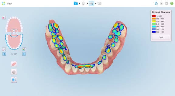 iTeroEd - iTero applications