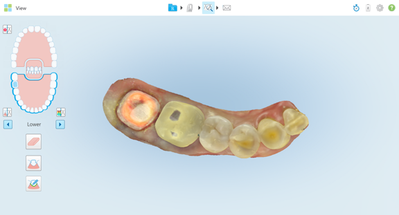 iTeroEd - iTero applications