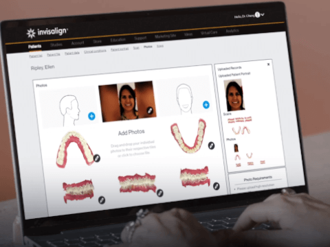 Cleaning and Disinfection Protocol for iTero Element intraoral scanners