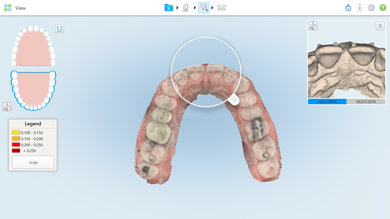 iTeroEd - iTero™ TimeLapse technology introduction