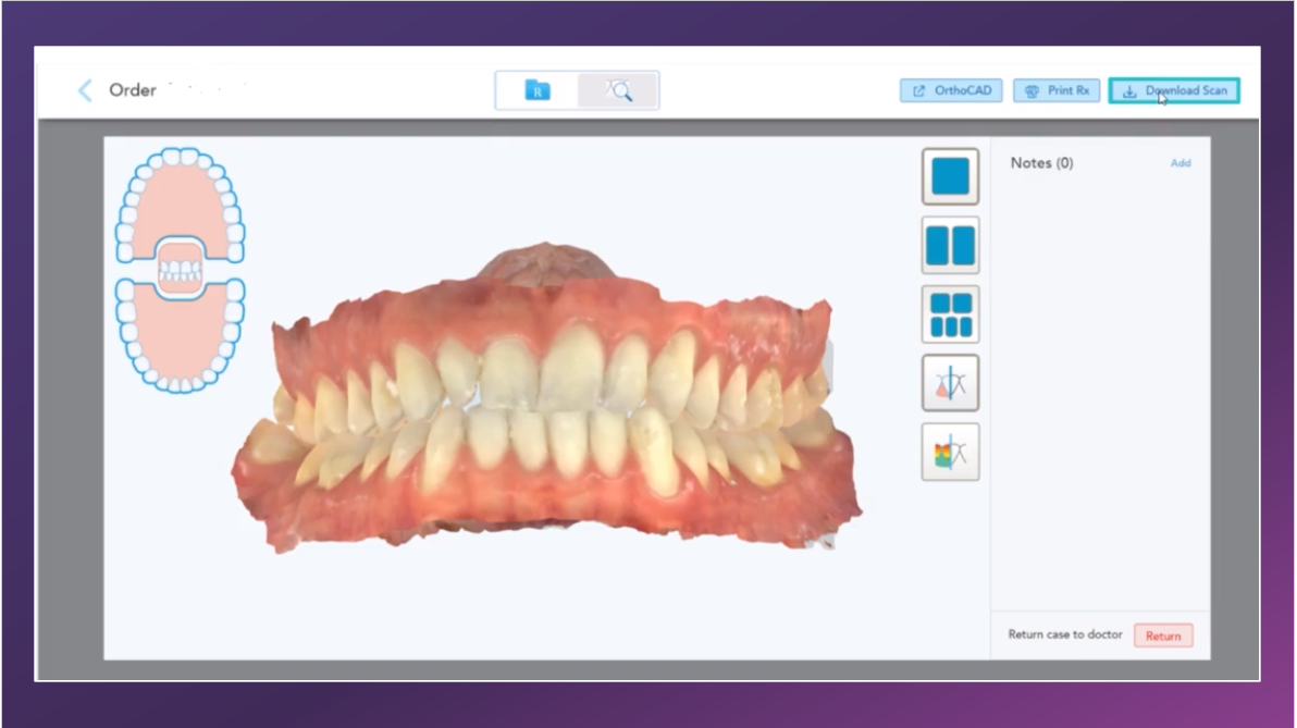 iTeroEd - iTero™ Lab