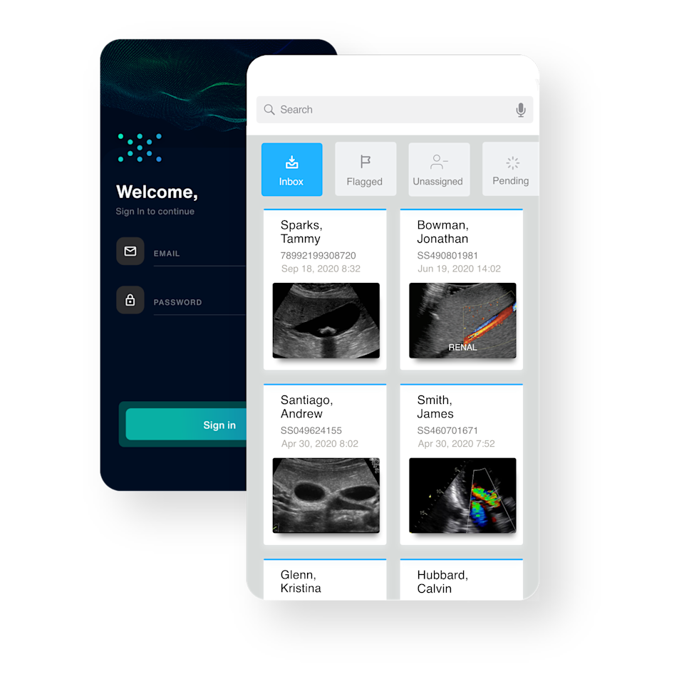 Ultrasound Workflow | Exo Works
