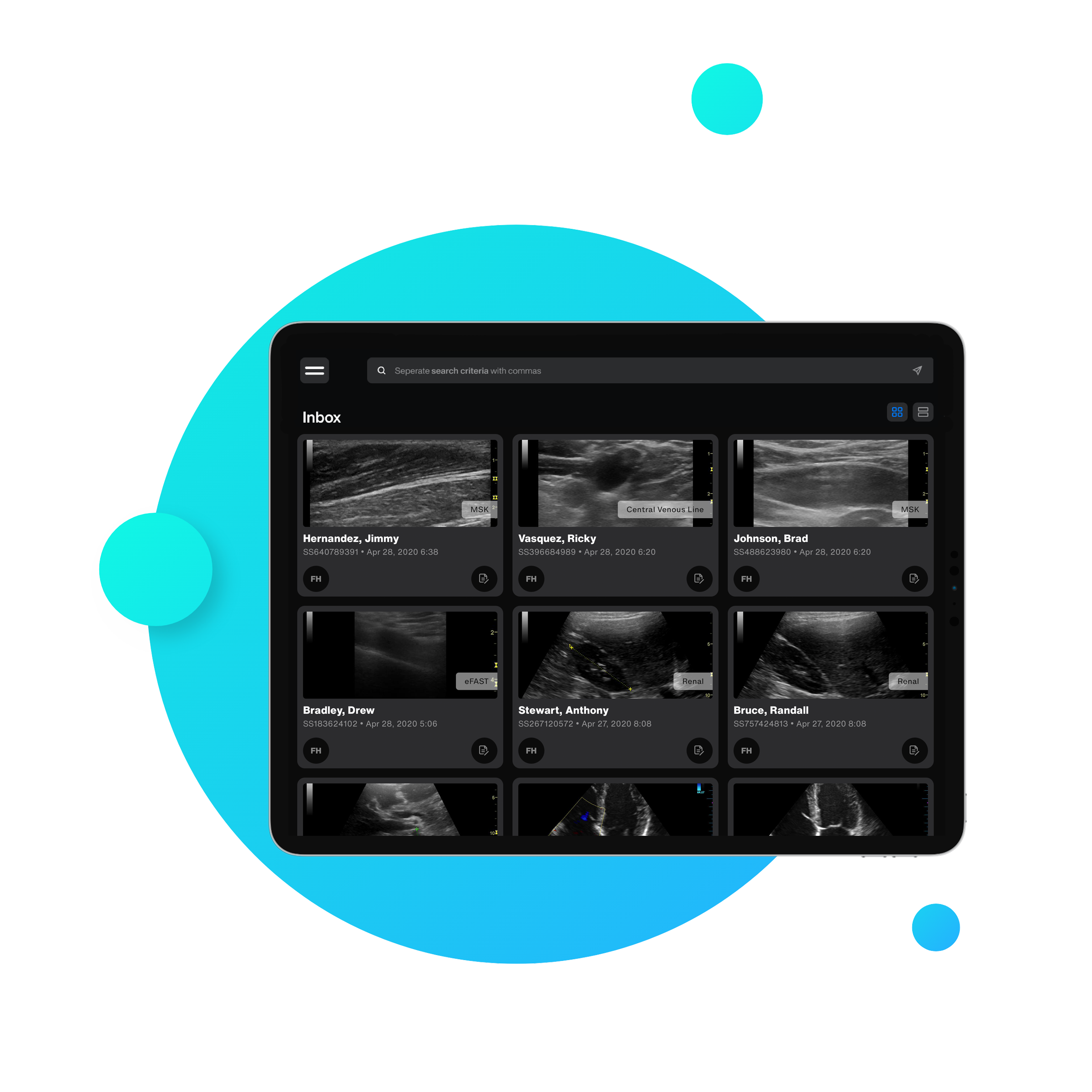 Ultrasound Workflow | Exo Works