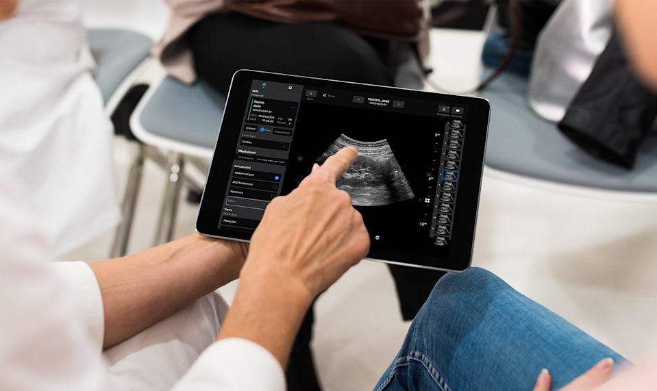 Point of Care Ultrasound Resources | Exo Imaging Resources