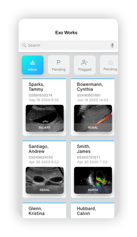Handheld Ultrasound | Point of Care Ultrasound - Exo
