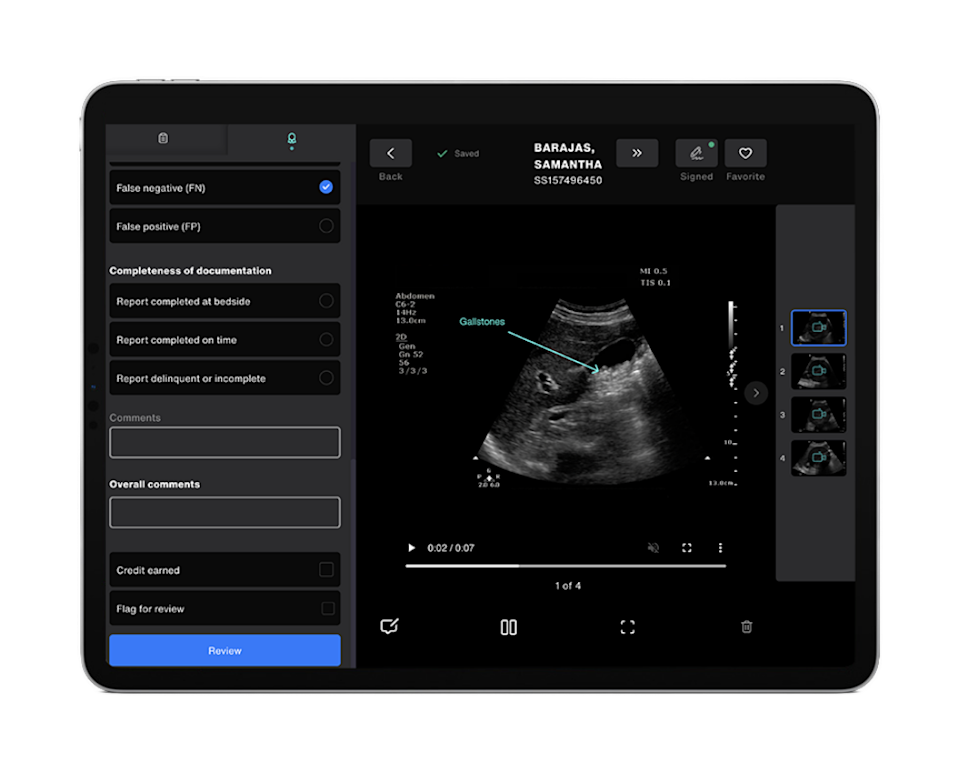 Ultrasound Workflow | Exo Works™