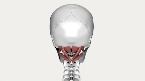 What Are Trigger Points?