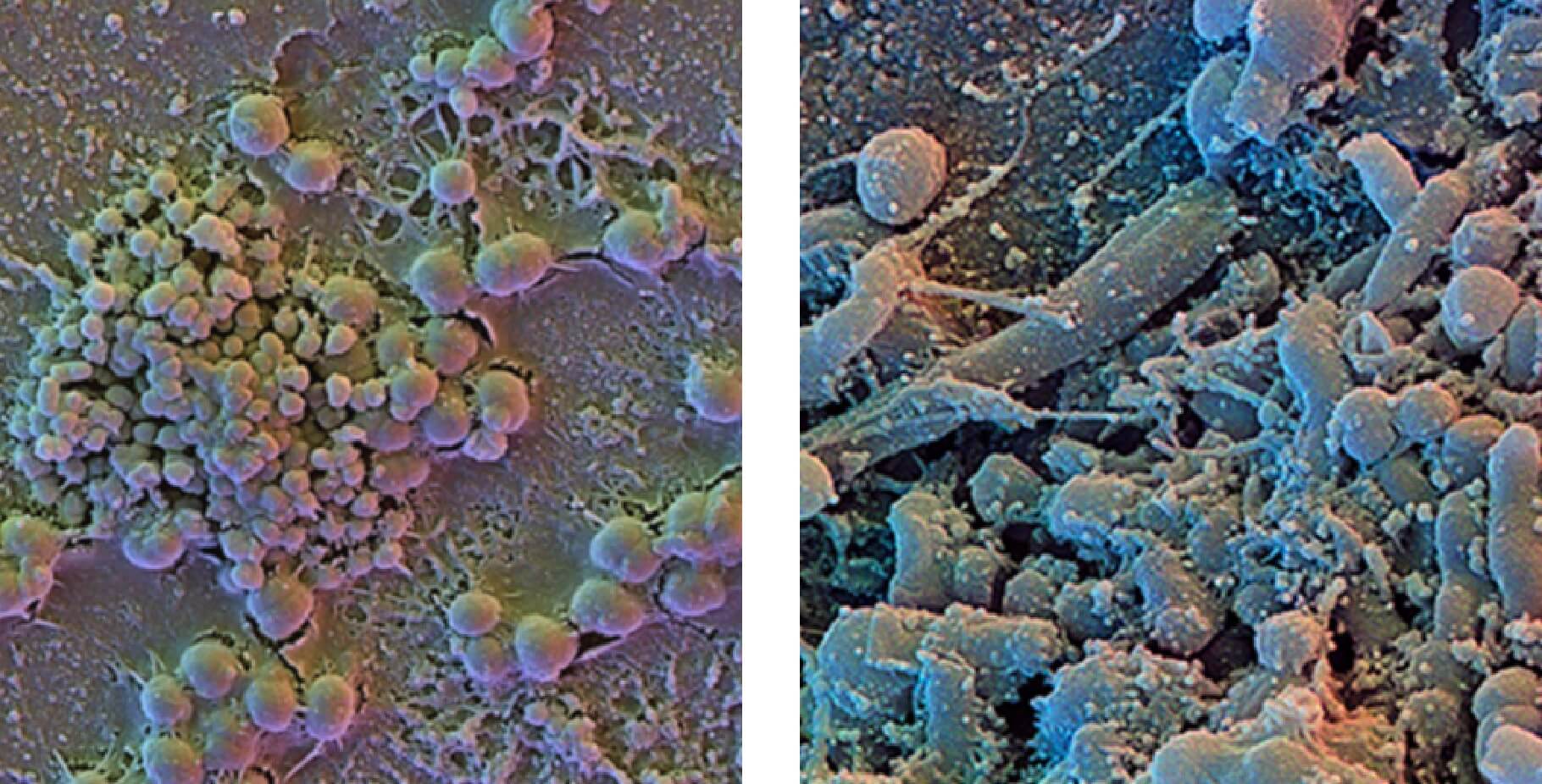 Na imagem à esquerda, o biofilme começa a aparecer em minutos. À ...