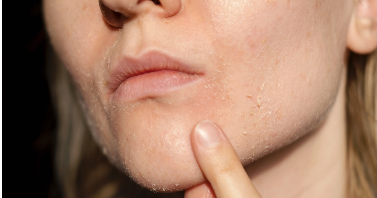 The 9 Retinol Mistakes You’re (Probably) Making, According to Experts