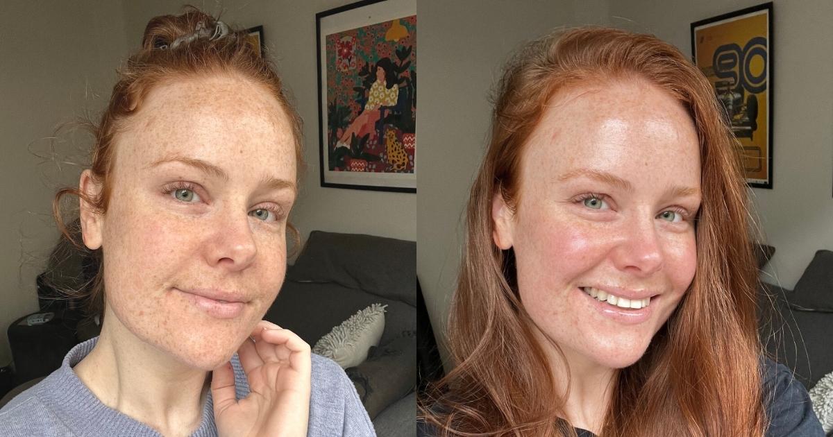 This asap Skincare Routine Made My Skin Glow like Nothing Else