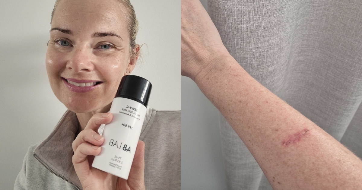 How not wearing sunscreen can cause serious damage like skin cancer ...