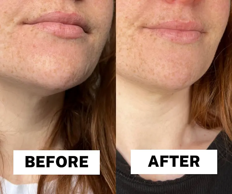 IT'S HERE: My Honest Thoughts on the New La Roche-Posay Cicaplast B5 Serum