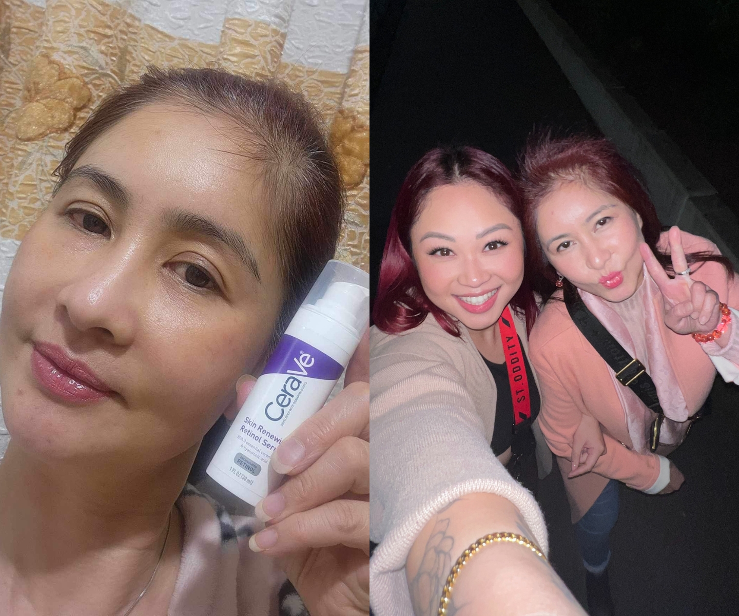 My Mum Tried CeraVe’s Skin Renewing Range for Firmer, Brighter Skin ...