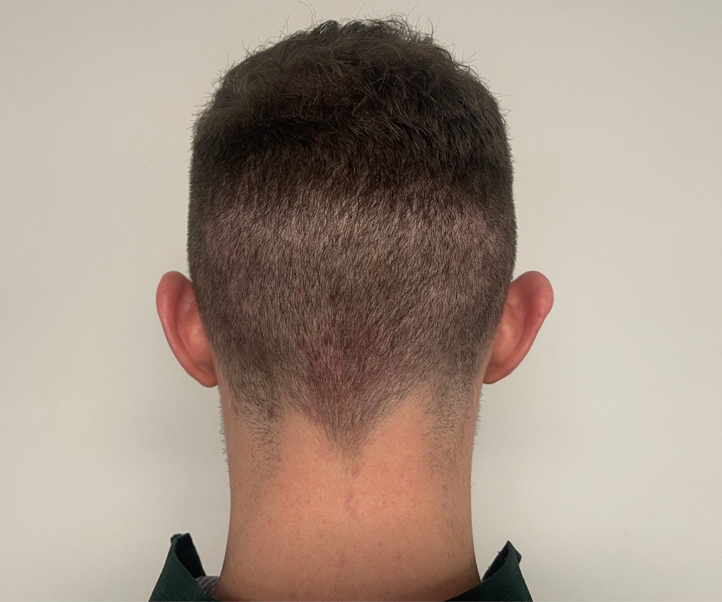 I Tried Kérastase’s New Haircare Range That Promises to Soothe Flaky Scalps