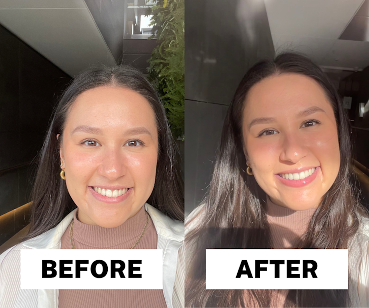 HiSmile V34 Review: Whitening Results - Adore Beauty