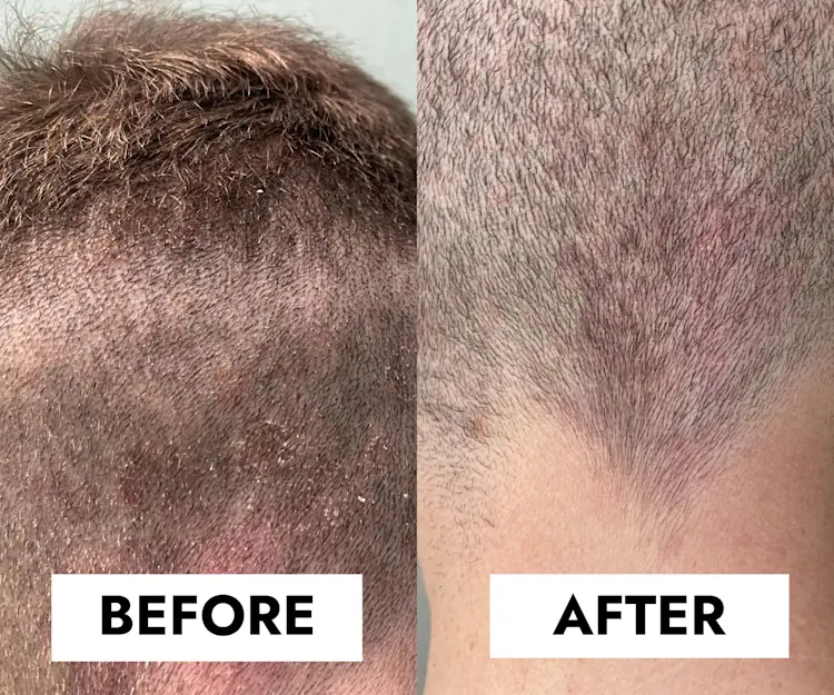 The best Kérastase hair serums and oils for different hair type and ...