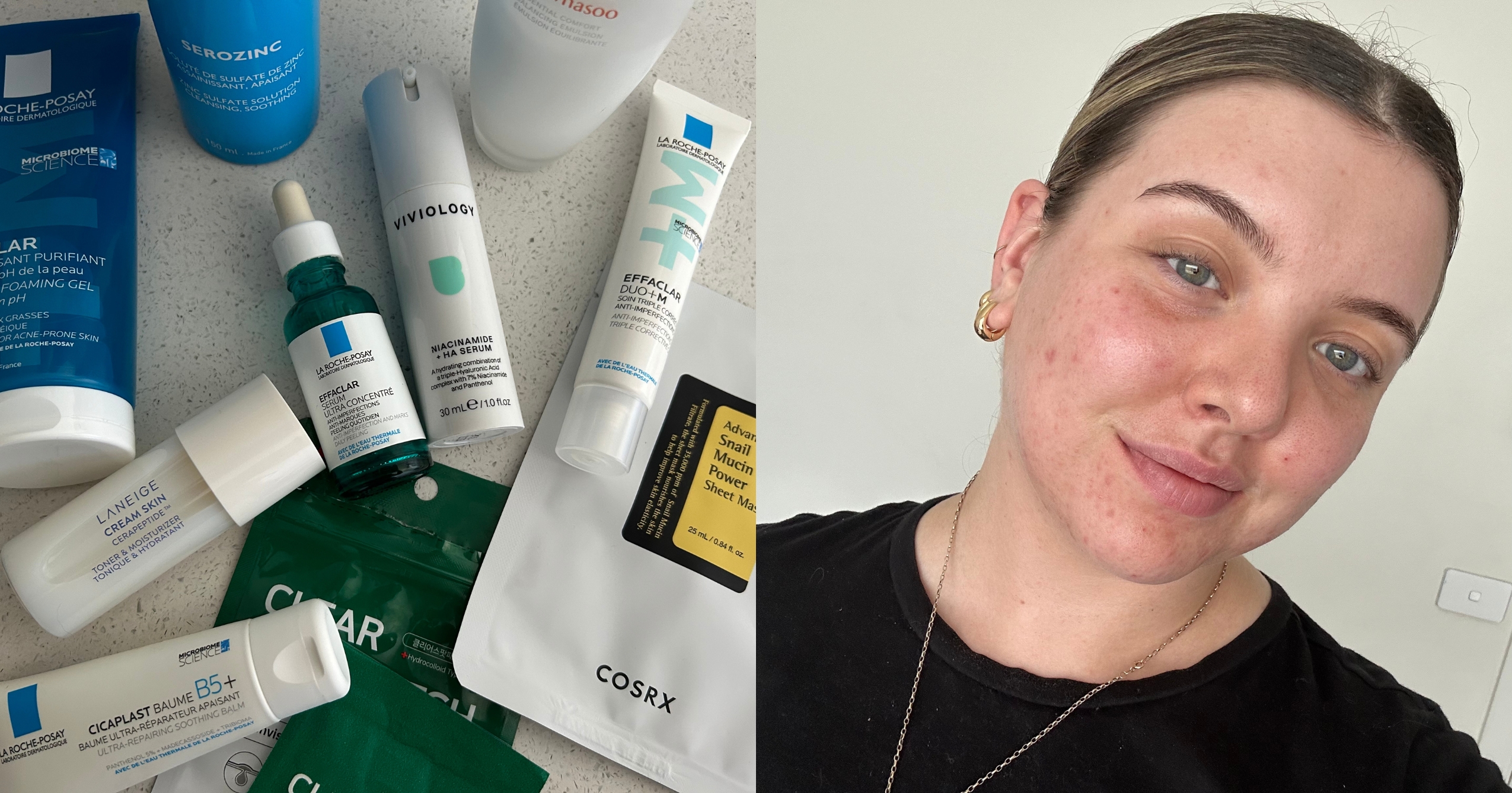 Skincare That’s Been Great for My Breakout-Prone Skin