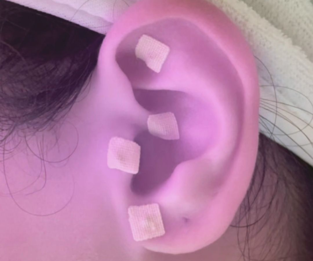 Can Ear Seeds Really Help You Stress Less and Sleep Better?