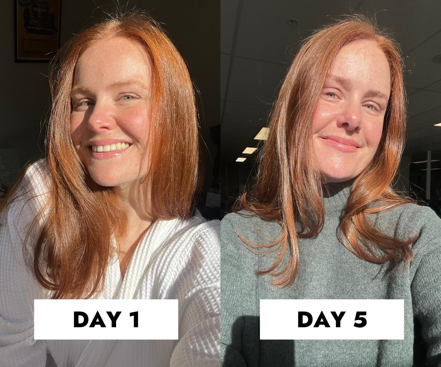 A Beauty Editor’s Verdict on the STRAAND Hair & Scalp Products You’re ...