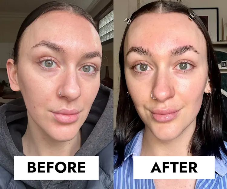 The Ordinary’s Rosehip Seed Oil Has Earned Its Best-Seller Badge, Here ...