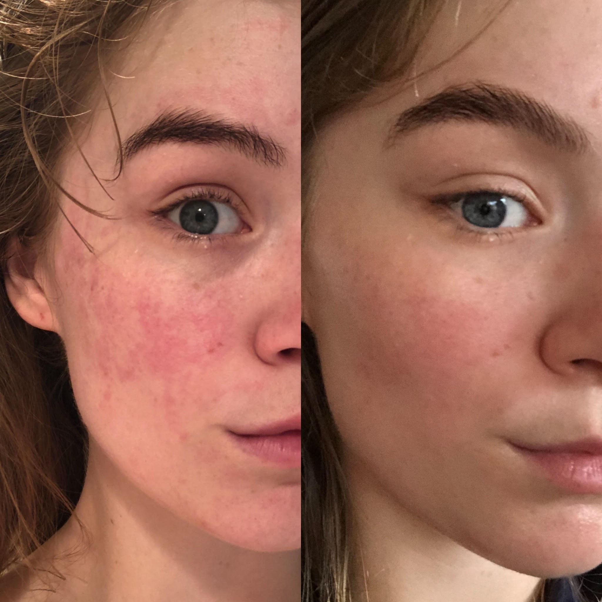 This Cleanser Has Transformed My Sensitive Skin