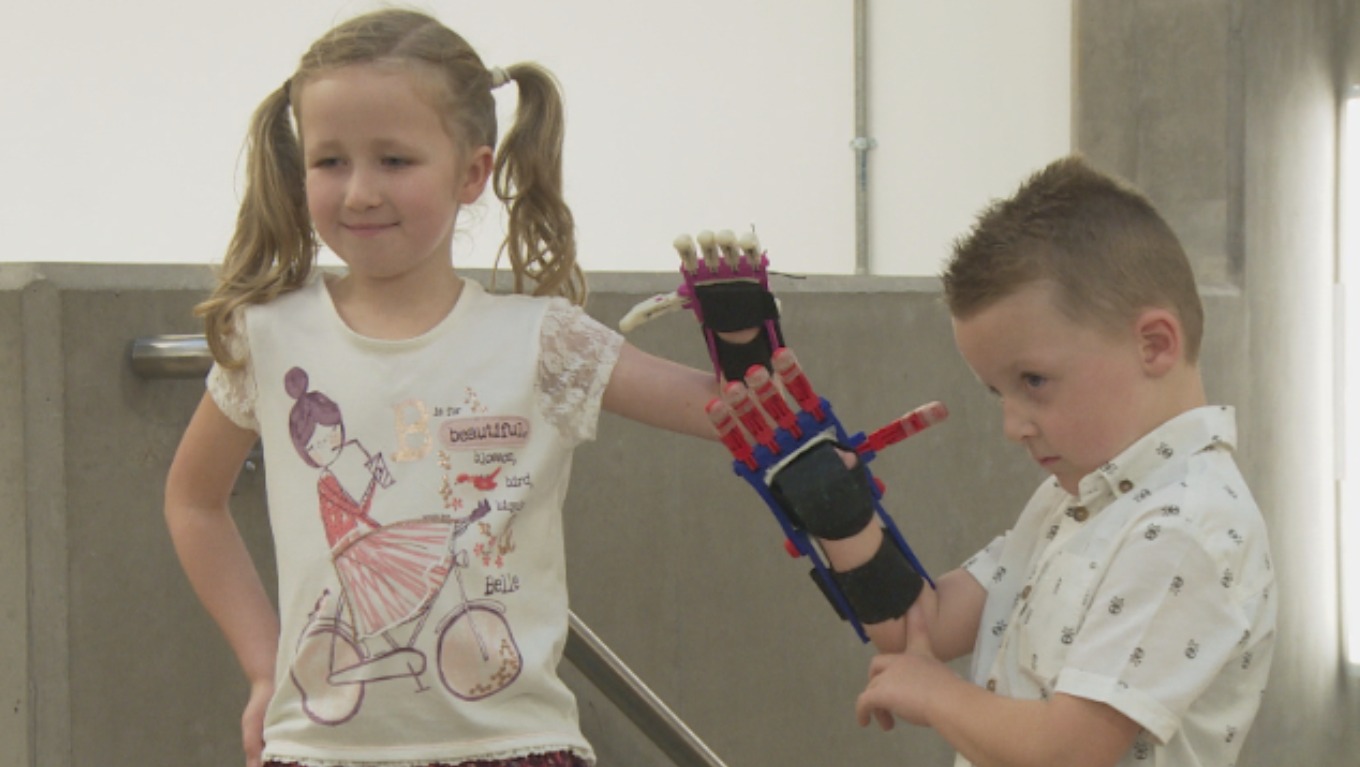 The revolutionary prosthetic hand that's transforming children's lives ...