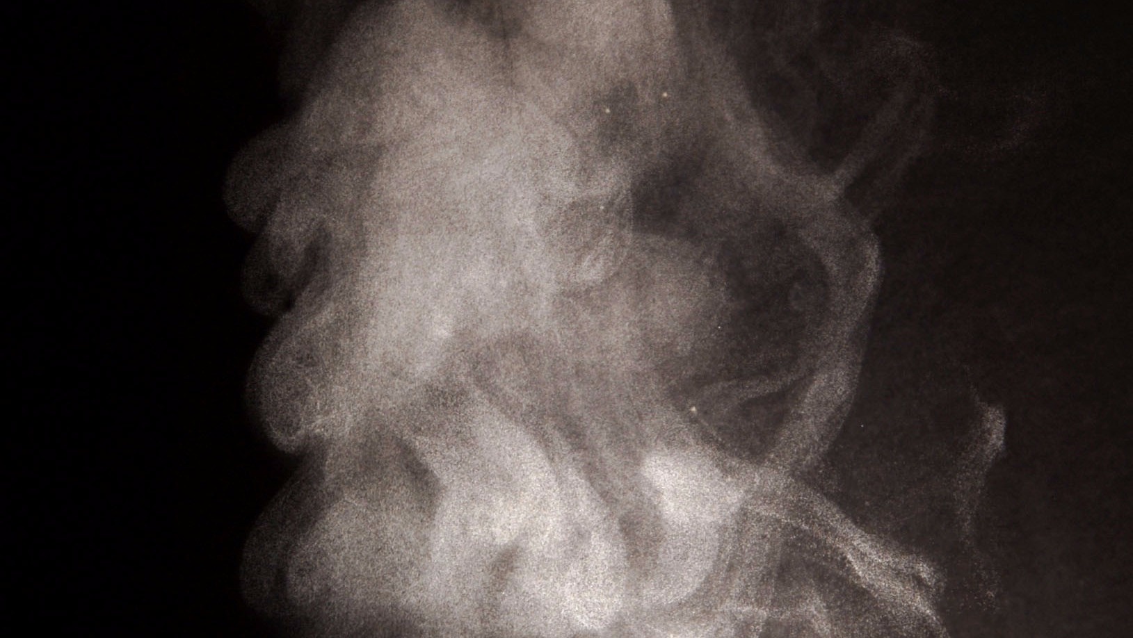 Burns warning over steam treatment for children's coughs and colds ...