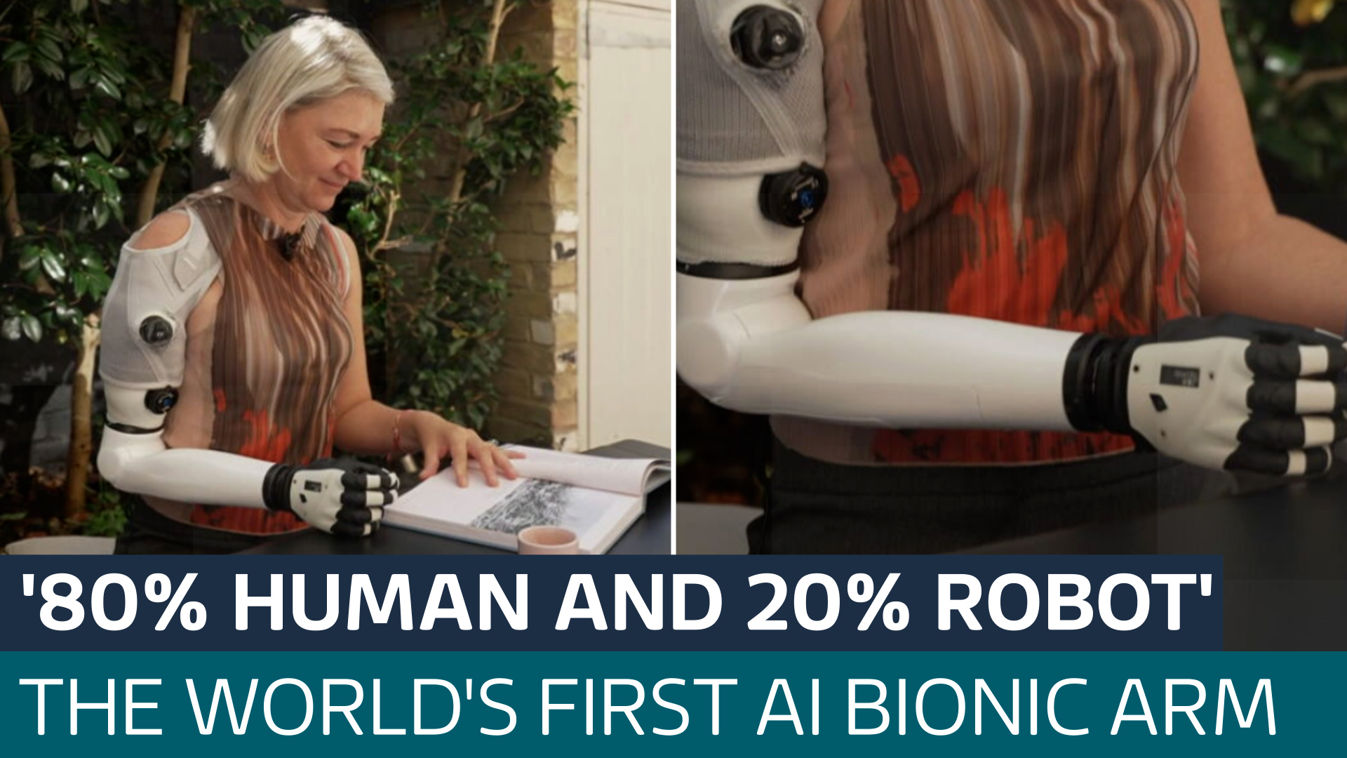 First person in the world fitted with AI-powered bionic arm - Latest ...