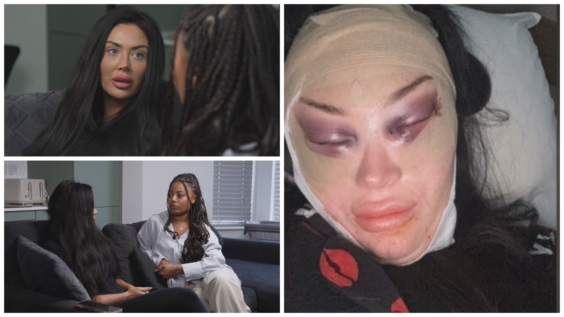 'She cut me with scissors': Inside the UK's underground cosmetic ...