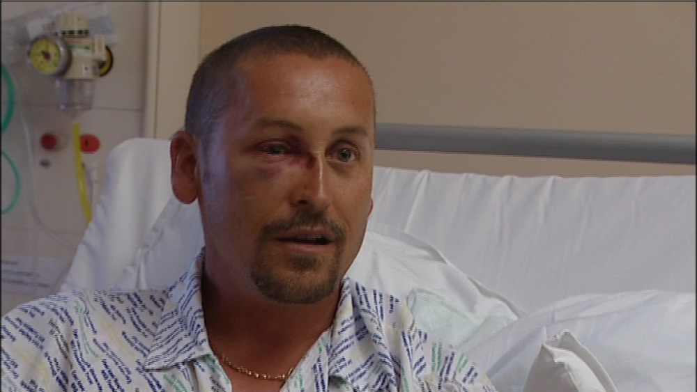 Man shot in face by air rifle | ITV News Meridian