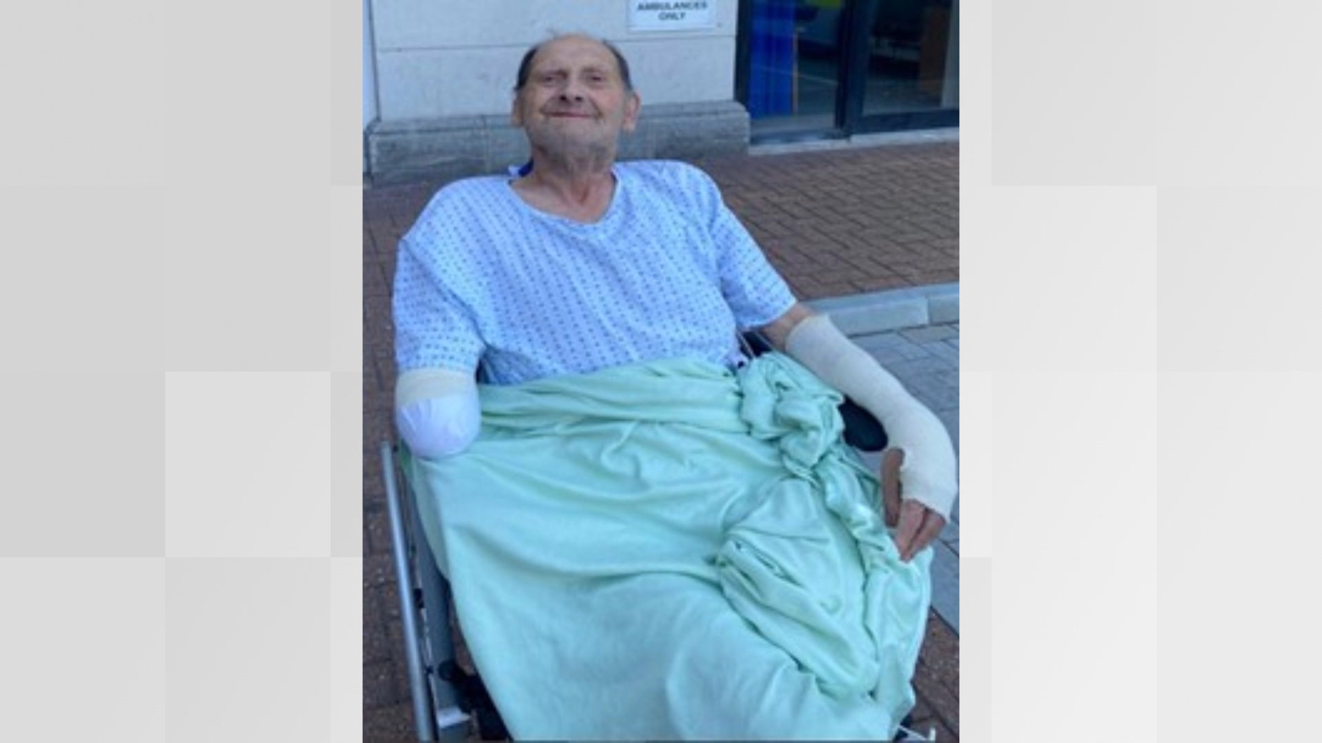 Man who lost arm and leg after dog attack in Sussex thanks emergency ...