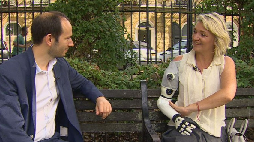 First ever 'mind reading' AI bionic arm given to woman run over by tube ...