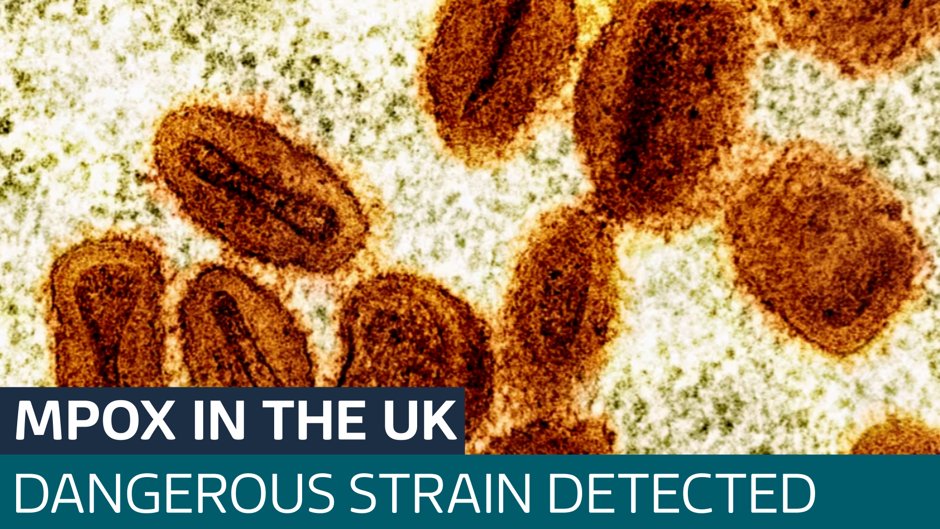 First case of potentially deadly mpox strain detected in UK - Latest ...