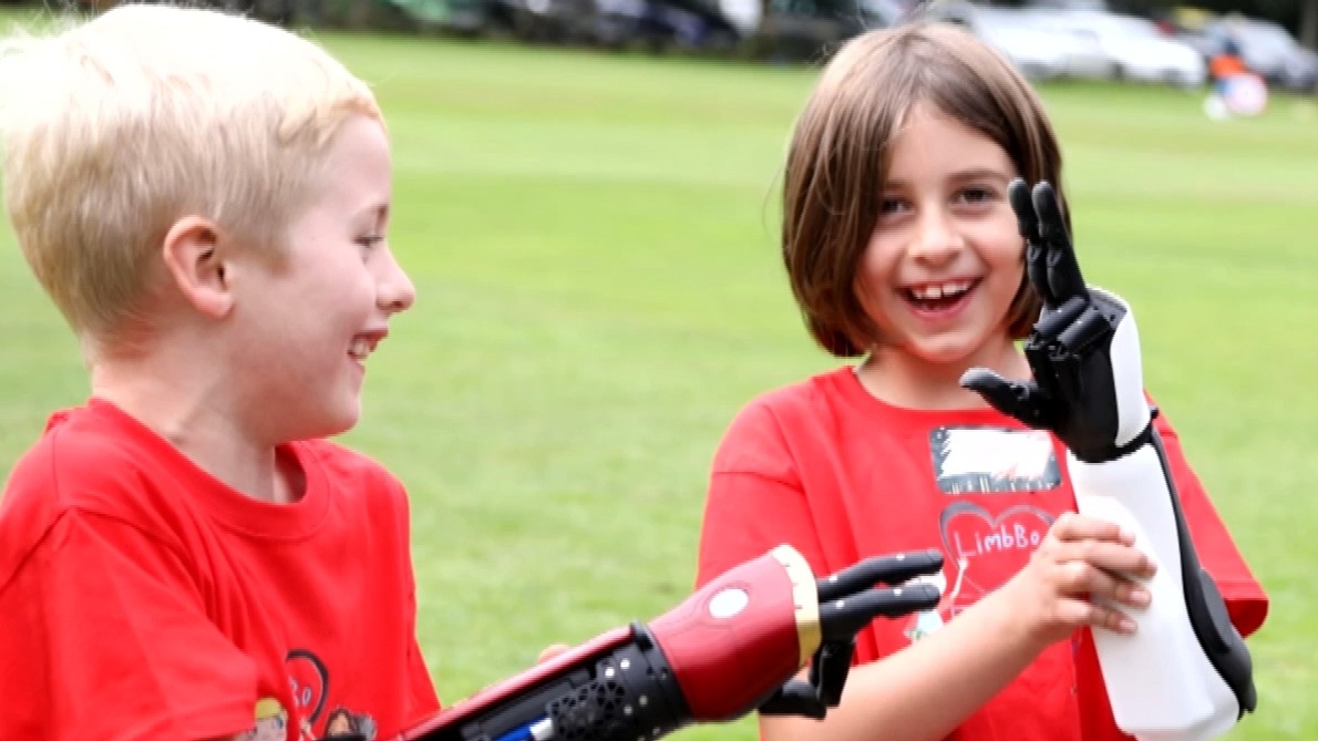 Seven-year-olds born with no hands campaign to raise money for life ...