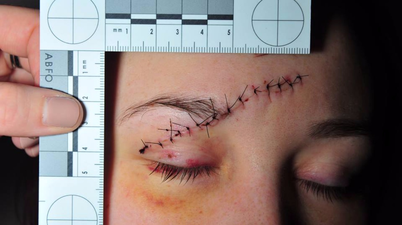 Woman jailed for bragging to friends on WhatsApp about glassing victim ...