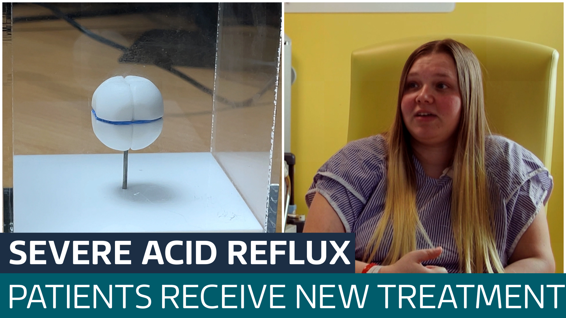 First patients in UK receive 'life changing' device to stop acid reflux ...