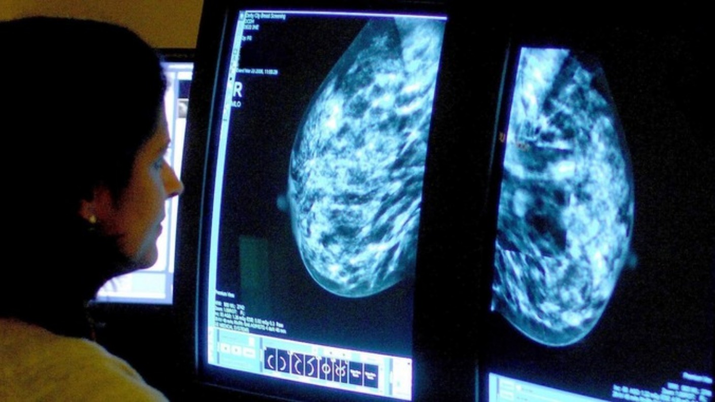 Welsh breast screening programme to be reviewed | ITV News Wales