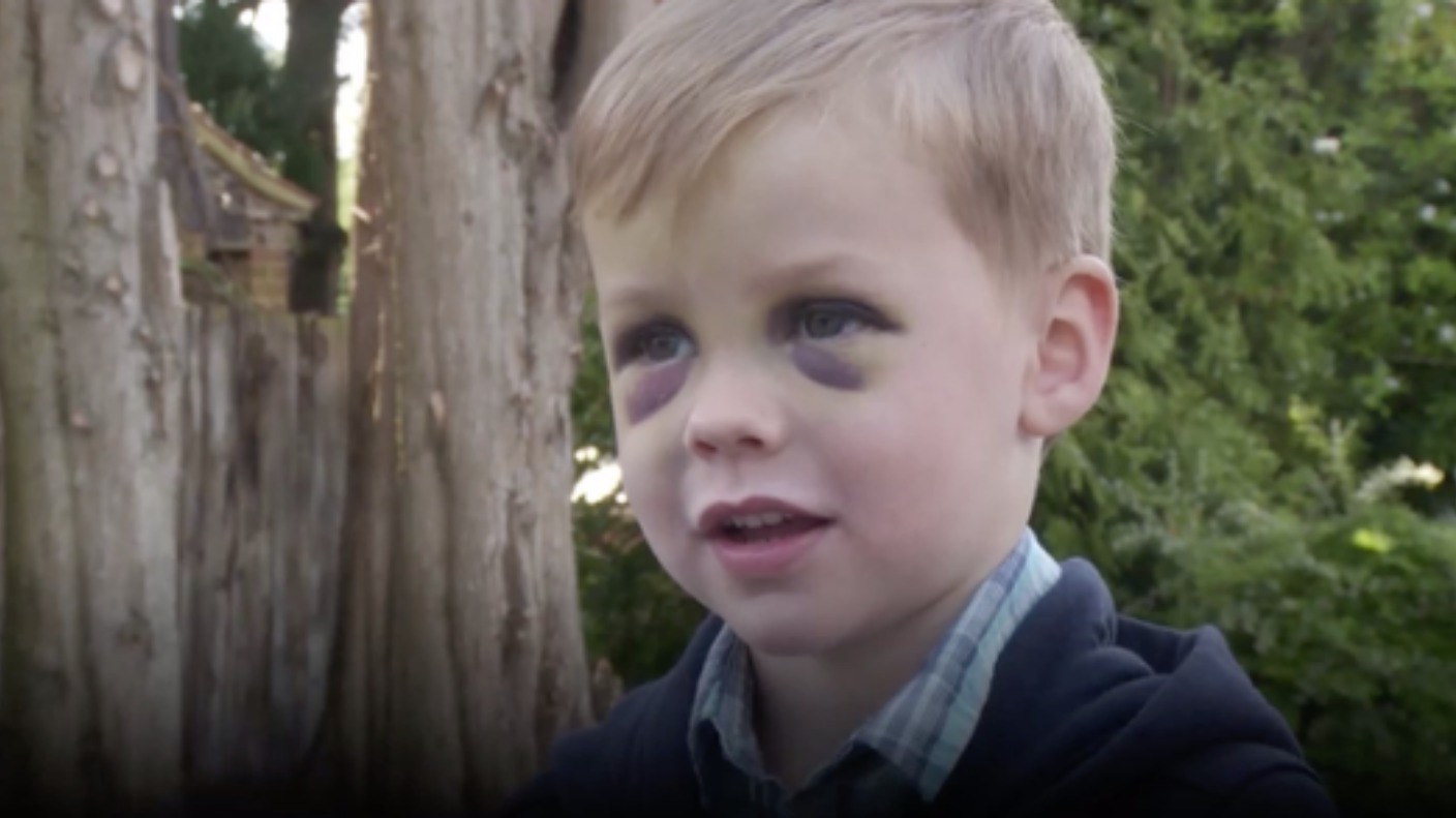 Boy's amazing escape after being hit in the head by a cricket ball ...