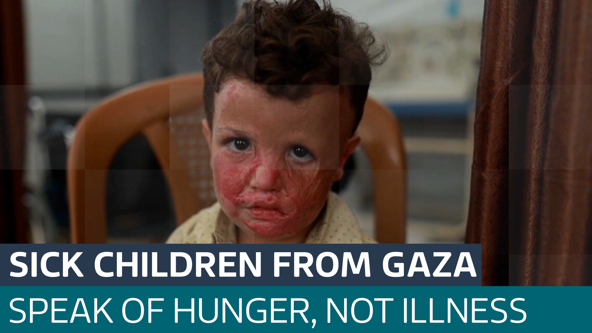 Gaza's sick children talk not of illness, but hunger as they arrive in ...