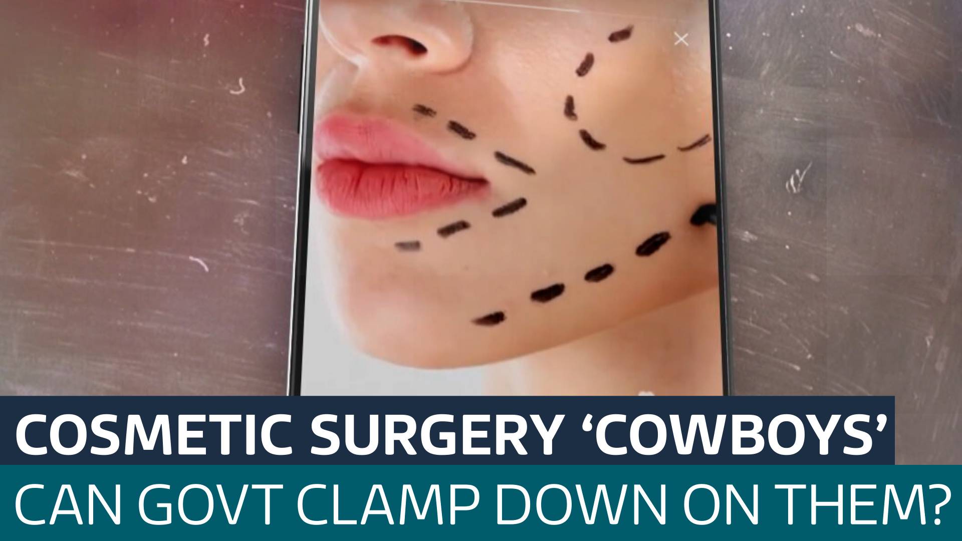 Health Secretary pledges to clamp down on cosmetic surgery 'cowboys ...