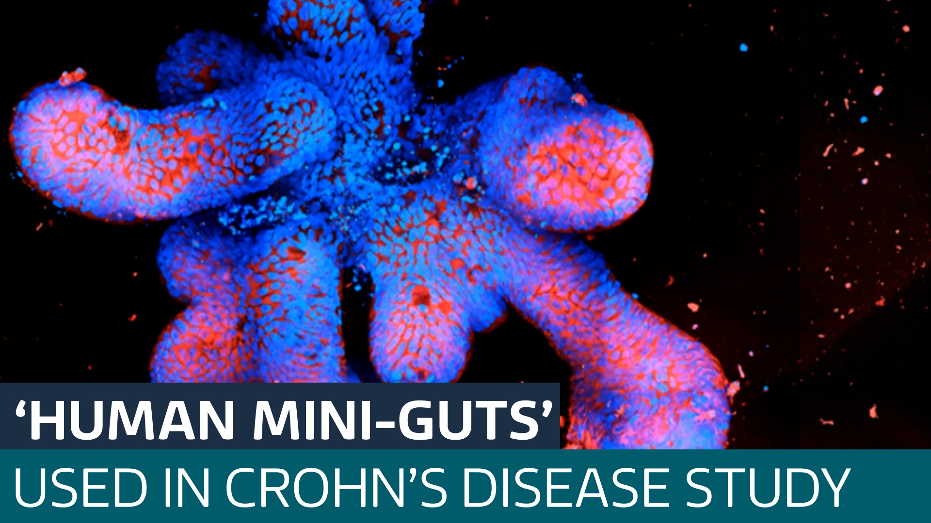 크론병 이해를 위한 '미니 인간 장기' 배양 - 레어노트