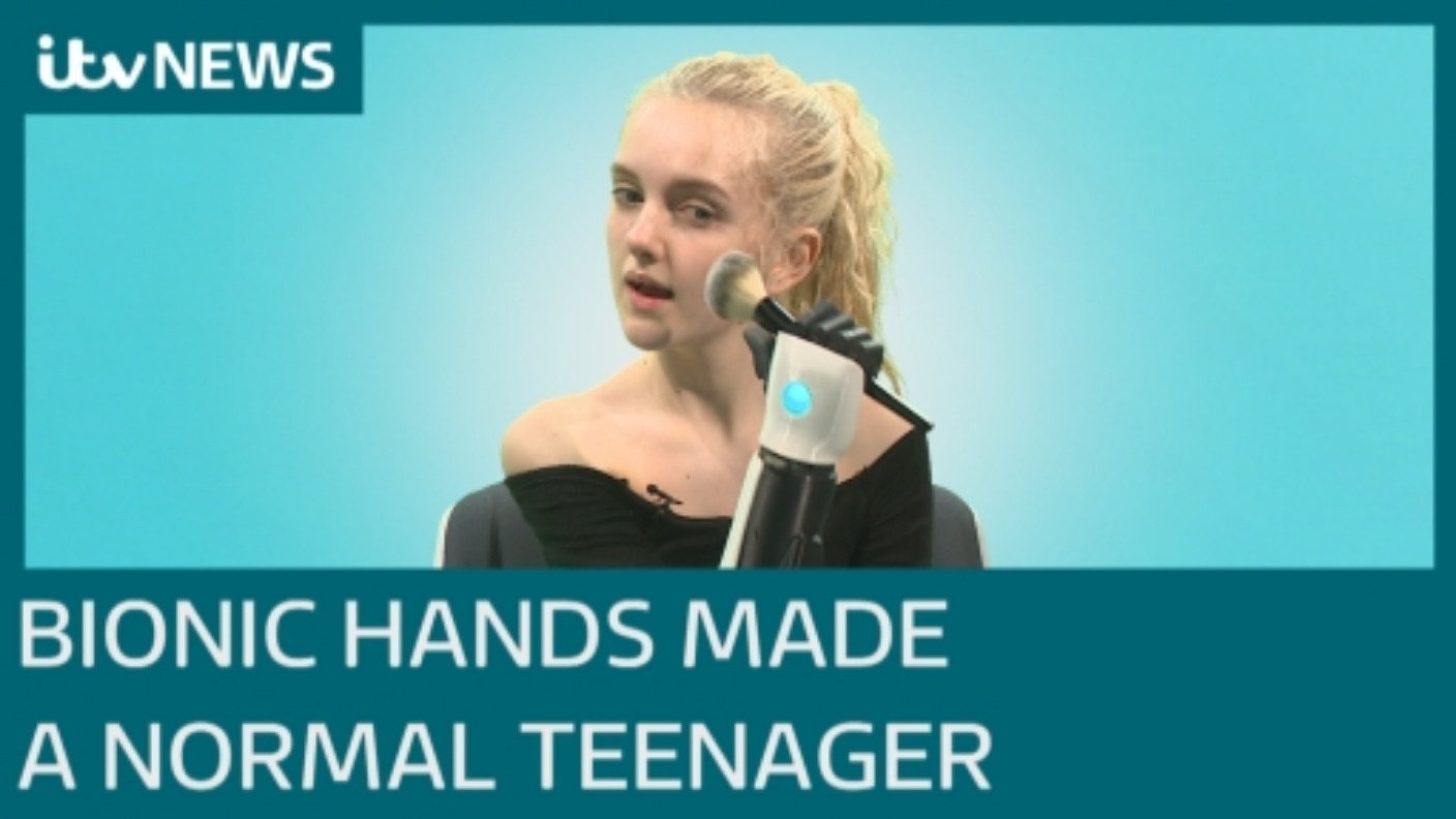 "How my bionic hands made me a normal teenager" | ITV News Tyne Tees