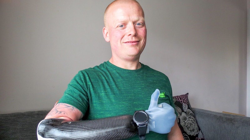 Firefighter receives £1.5m compensation after injury led to hand being ...